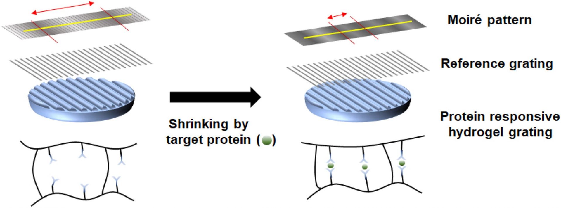 Умная контактная линза диагностирует болезнь Альцгеймера на ранней стадии