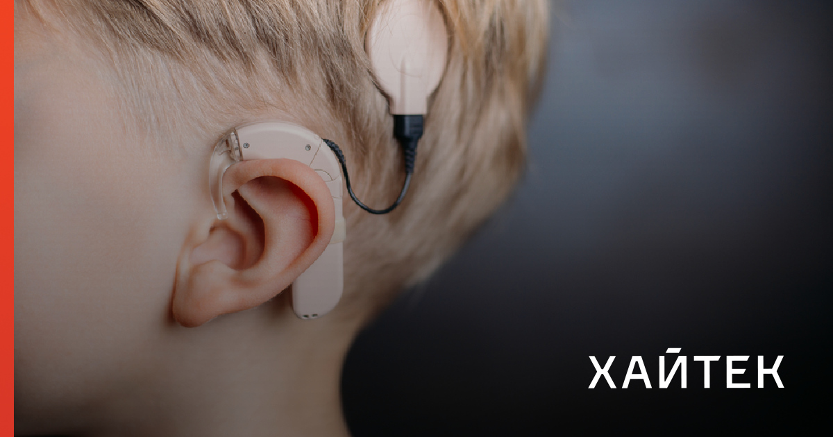 Новый слуховой имплант считывает активность мозга и настраивается под ...